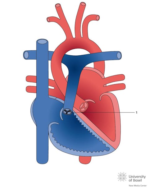 Pulmonaalklepstenose | Stichting Hartekind