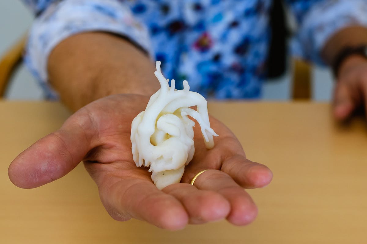 Cardiomyopathie | Stichting Hartekind